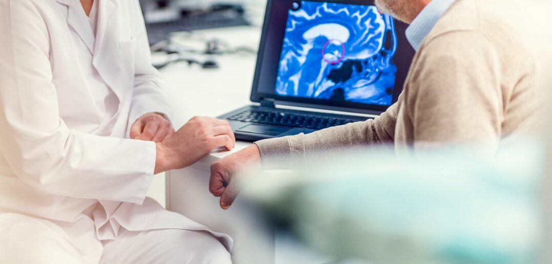 Sclerosis multiplex: milyen kilátásai vannak a betegeknek? | Pannondoktor.hu